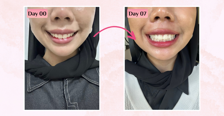 DARLIE All Shiny White Enzyme Toothpaste Review