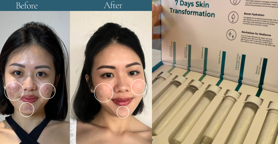 Enjoy a 1-for-1 Deal on Ice's Secret's New Mask Which Promises Clear, Radiant Skin in Just 7 ...