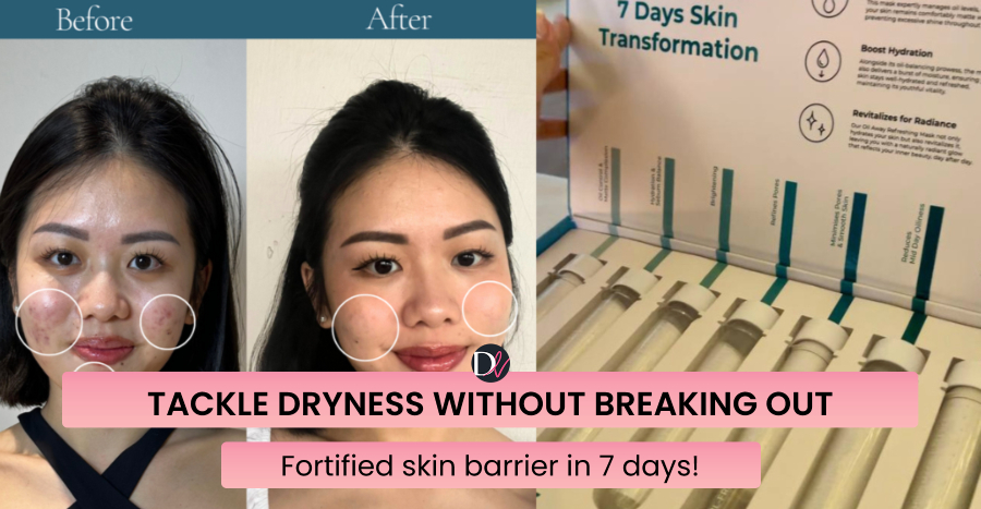 Enjoy a 1-for-1 Deal on Ice's Secret's New Mask Which Promises Clear ...