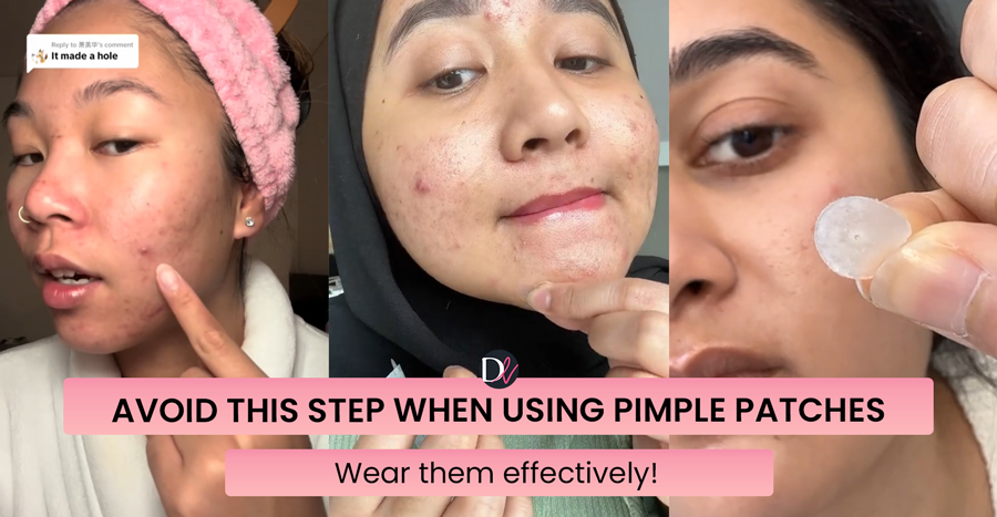 This Is Why Your Pimple Patches Don't Work - Plus, Tips to Apply Them ...