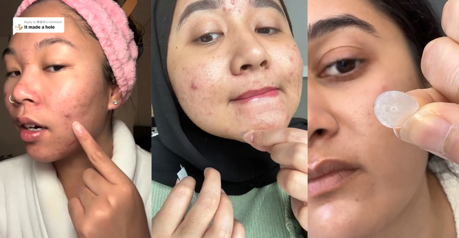 This Is Why Your Pimple Patches Don't Work - Plus, Tips to Apply Them ...