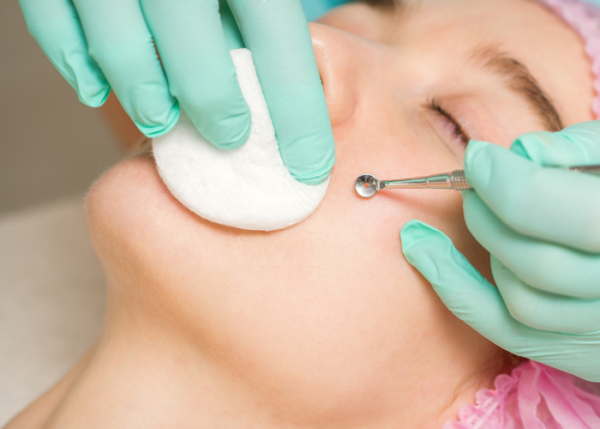 12 Best Extraction Facials in Singapore (2024)