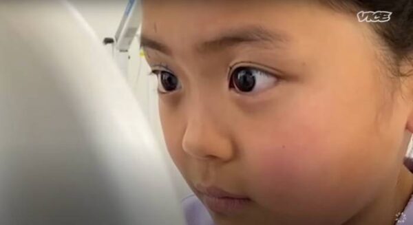 Plastic Surgery for Minors in Japan: Should It Be Allowed? | Daily ...