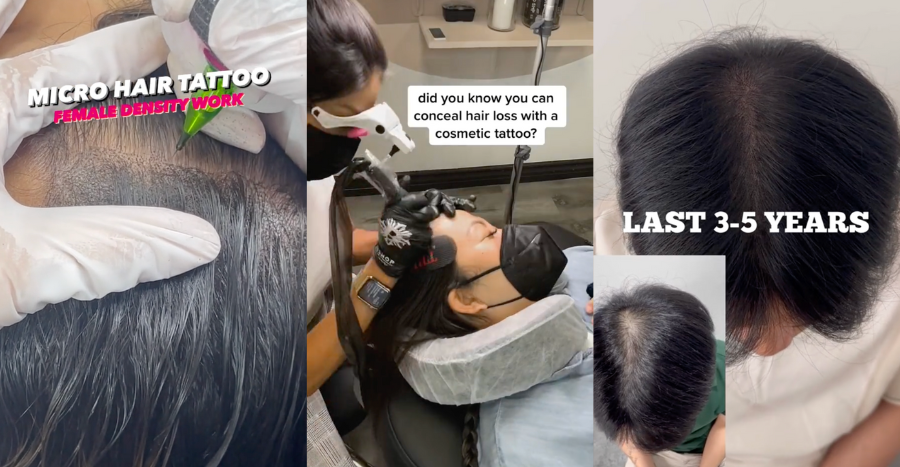 Scalp Micropigmentation (SMP): Benefits & Where to Get It