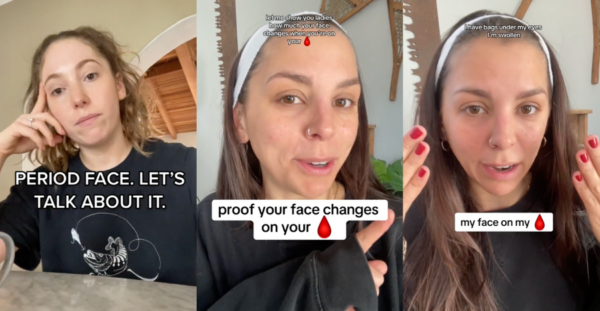 "Period Face": How Your Menstrual Cycle Messes With Your Skin and How ...