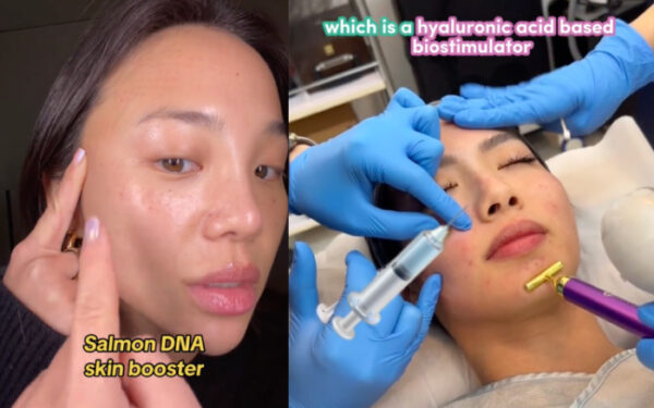 Injectable "Skin Boosters": 7 Best Clinics, Results, and More
