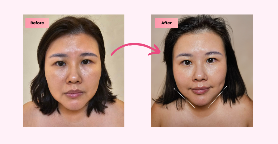 This Facial (Now: $38!) Was So Good, I Skipped My Botox Appointment ...