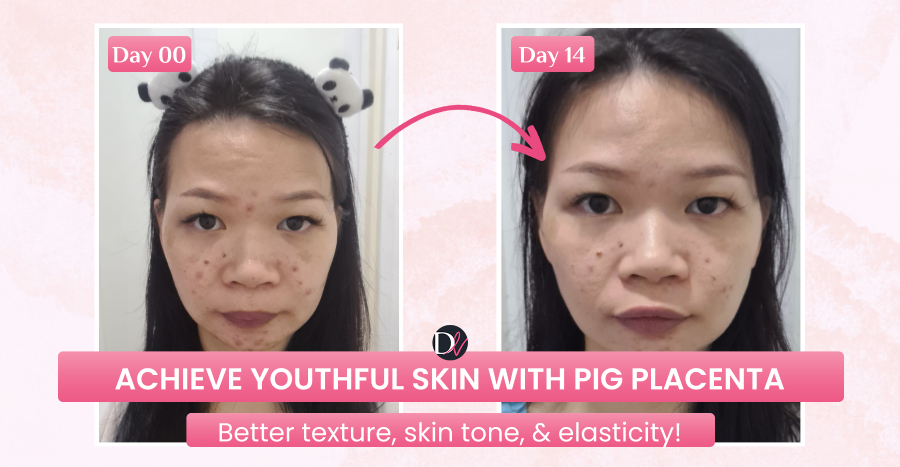 Bb lab. Placenta Extract Review