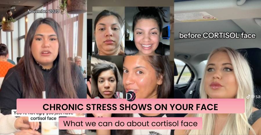 You're Not Overweight, You Just Have Cortisol Face - Here's What You ...