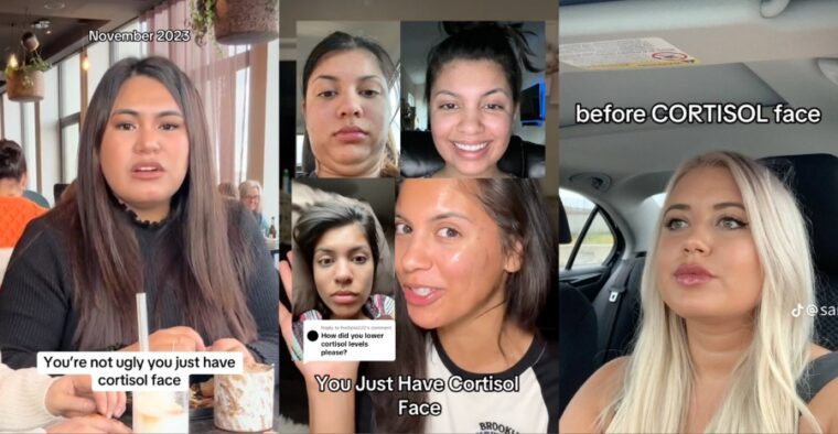 You're Not Overweight, You Just Have Cortisol Face - Here's What You ...