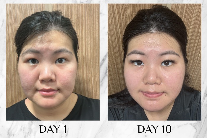 Avène CLEANANCE A.H.A Exfoliating Serum Reviews