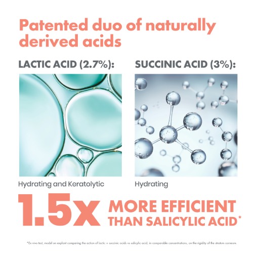 Avène Cleanance Comedomed Peeling Intensive Spot Breakout Cream Review