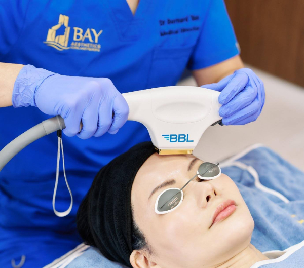 Sciton BBL HERO and MOXI Laser Singapore: A Complete Guide | Daily Vanity Singapore