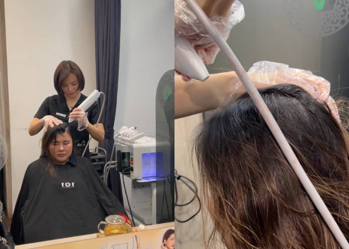 We’ve Found An Effective Hair Loss Treatment for Just S$50! (U.P S$724 ...