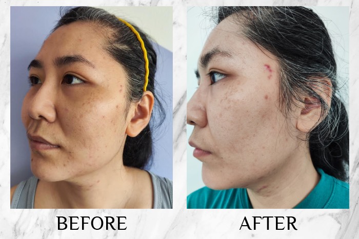 Doki Doki Luna Shot Collagen Reviews