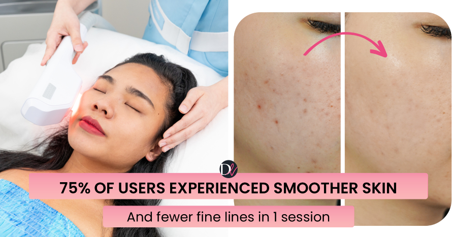 This New 3-In-1 Facial Technology Erases Fine Lines, Acne, and ...